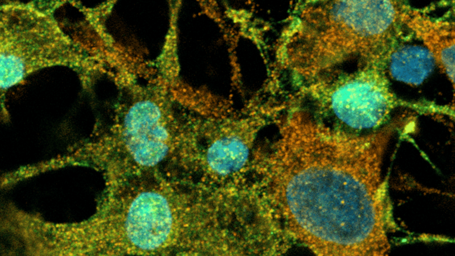 Excellence in Neuroinflammation Award 2025 – Epitech Group spa